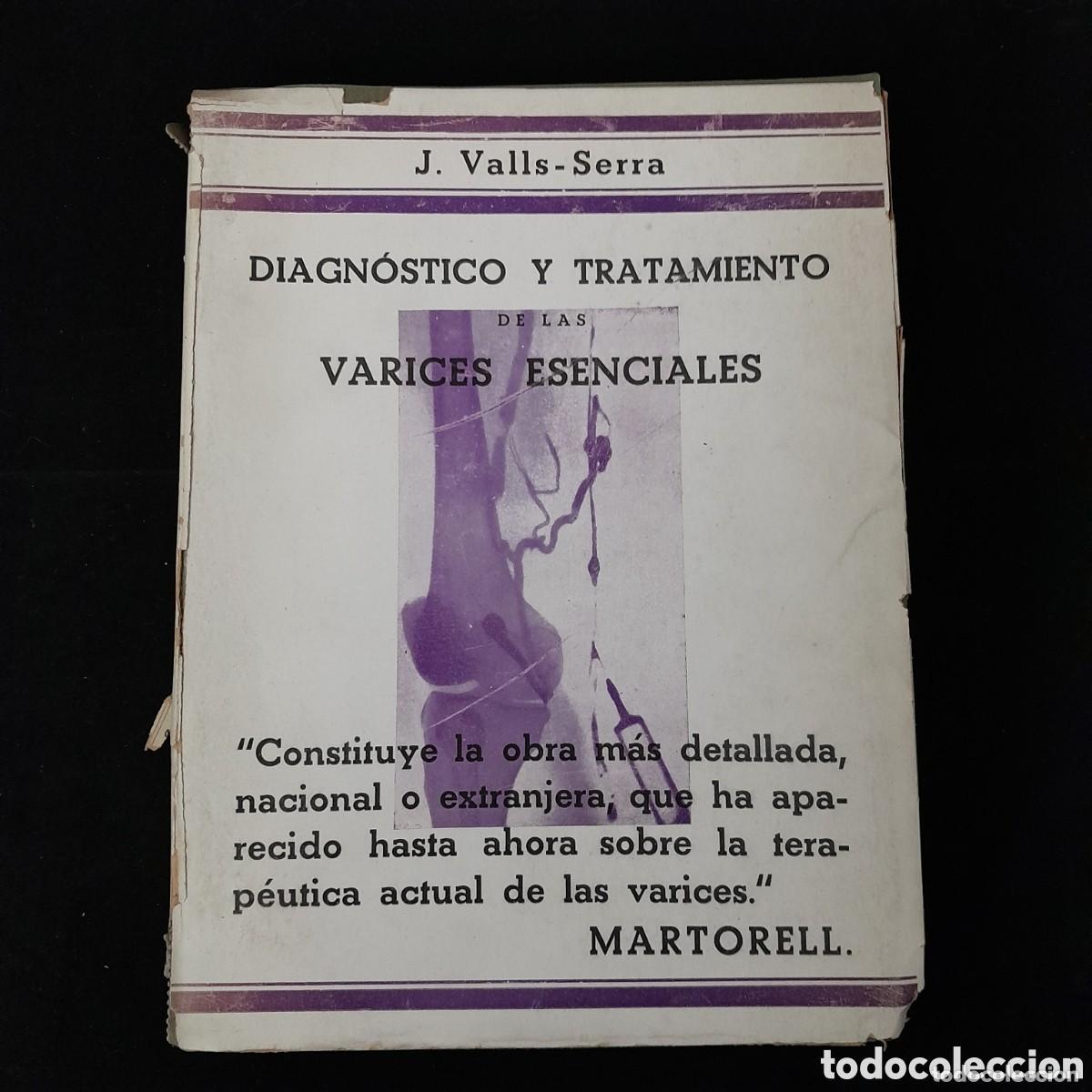 diagnóstico y tratamiento de las varices esenci - Compra venta en ...